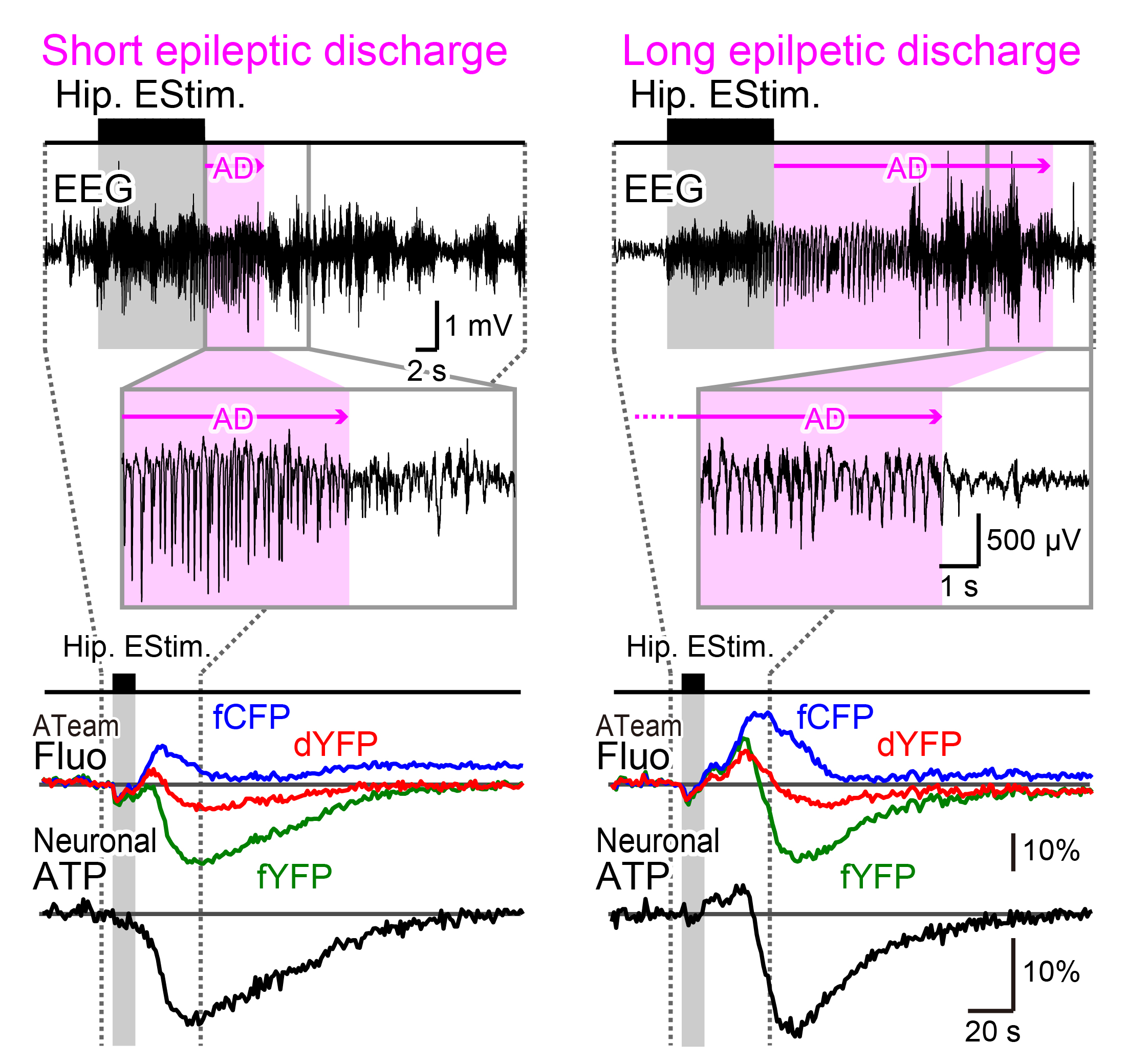 Revealing Brain Energy Dynamics: Decoding the Response to Epileptic ...