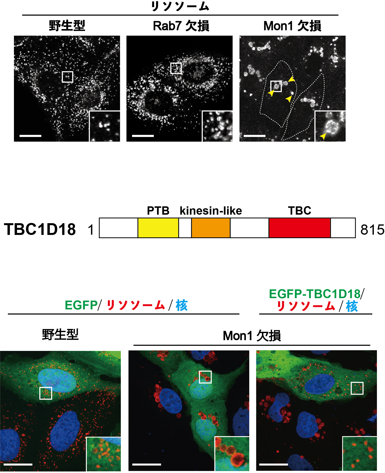 エンドソーム成熟を制御する新機構を発見 〜細胞内に取り込んだ物質の分解に必須の新規因子を同定〜｜東北大学 大学院 生命科学研究科